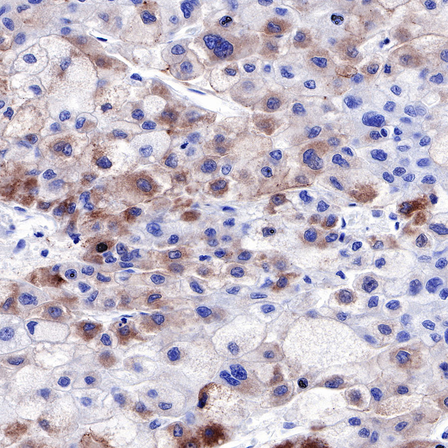 S-RMab® Glypican-3 Recombinant Rabbit mAb (SDT-R032),P51654_Starter Bio S-RMab® Glypican-3 Recombinant Rabbit mAb (SDT-R032),P51654_Starter Bio